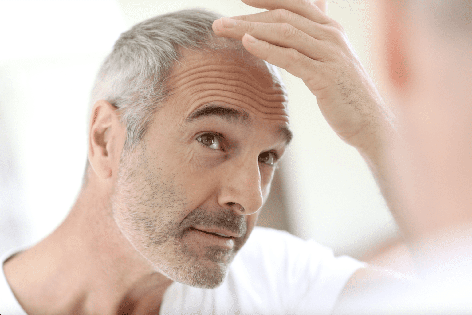 Alopecia (Hair Loss) Treatment Bexhill