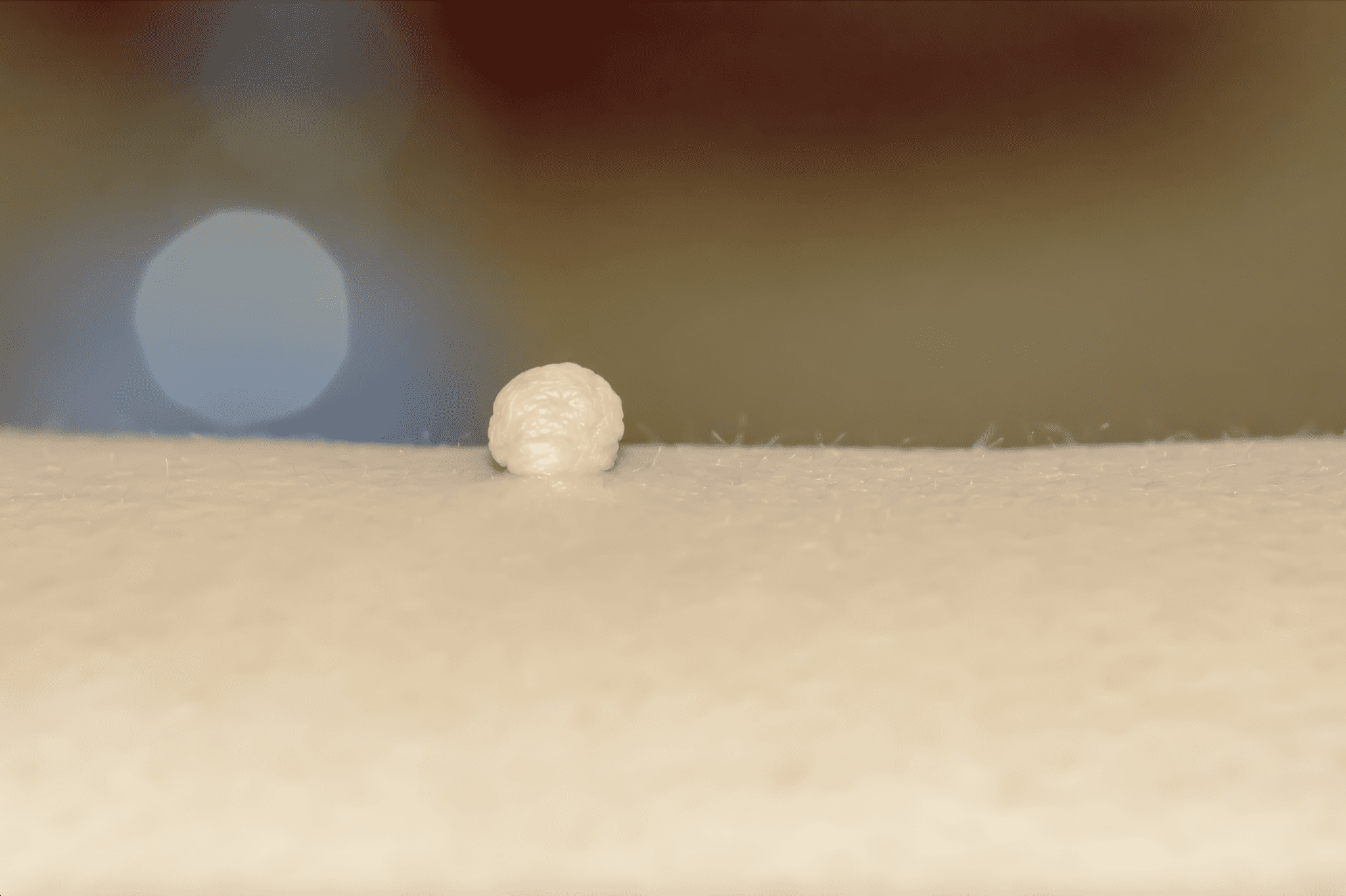 Skin Tag Removal in Bexhill, East Sussex