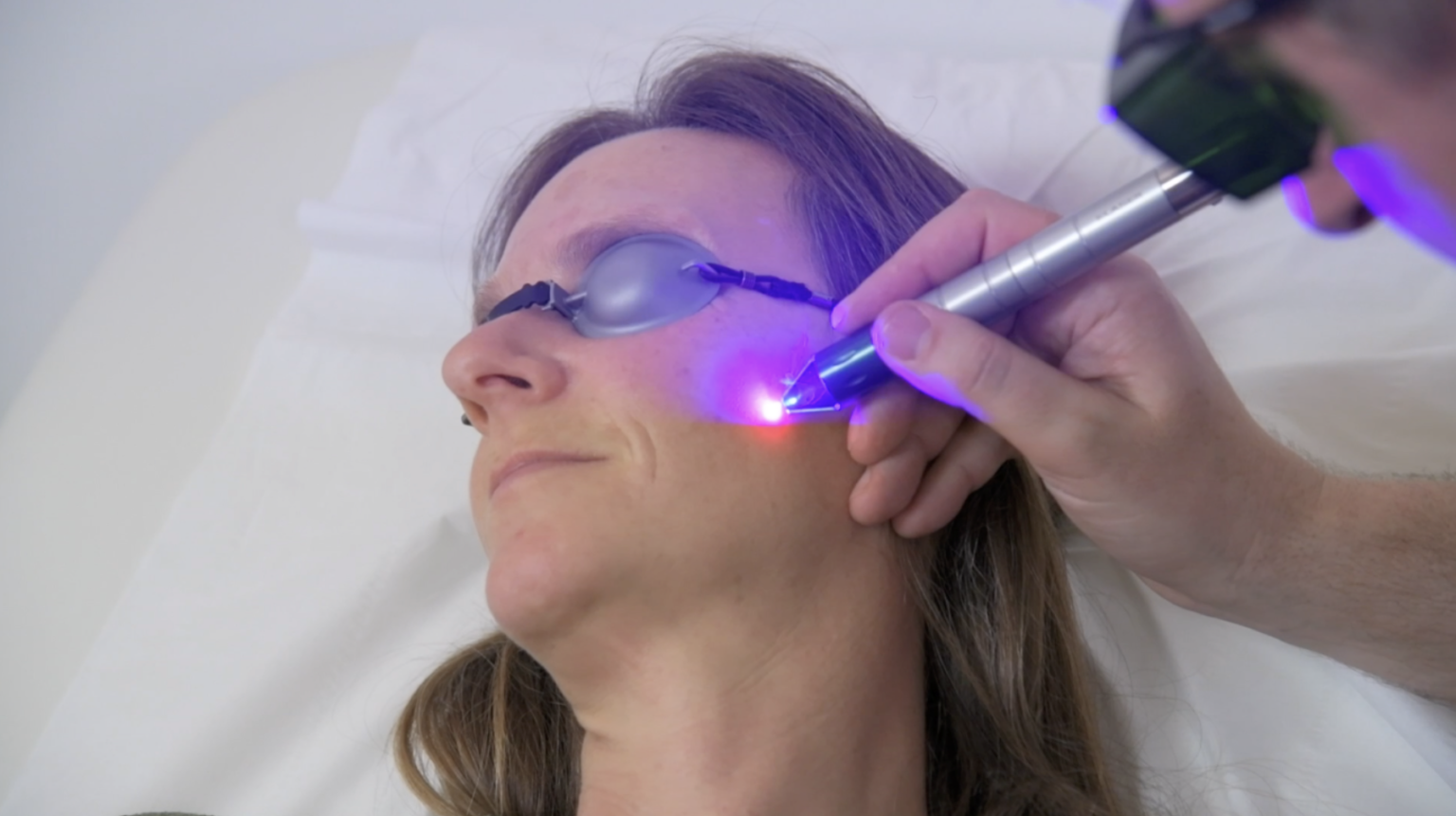 Revolutionary K-LASER BLUE DERMA laser now available at our Bexhill ...